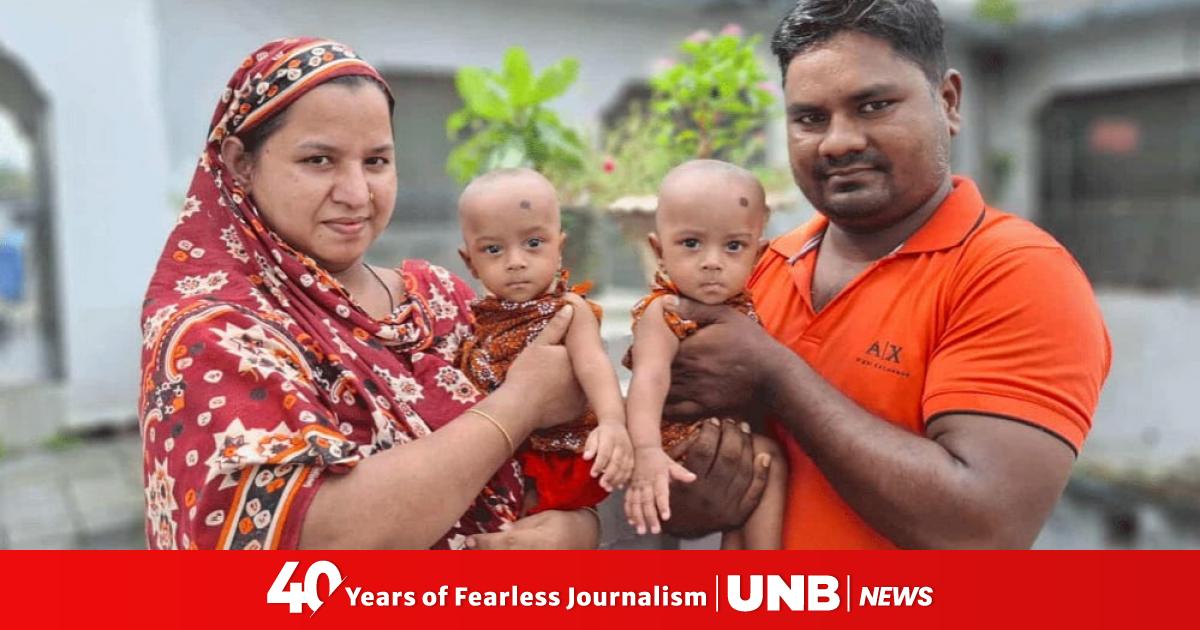 Conjoined twins Juhi, Ruhi on way home after successful separation